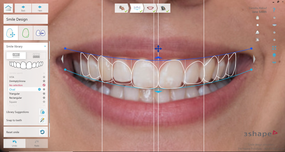 牙醫界的劃時代進步，3Shape TRIOS 5 數位口掃機七大功能全解析